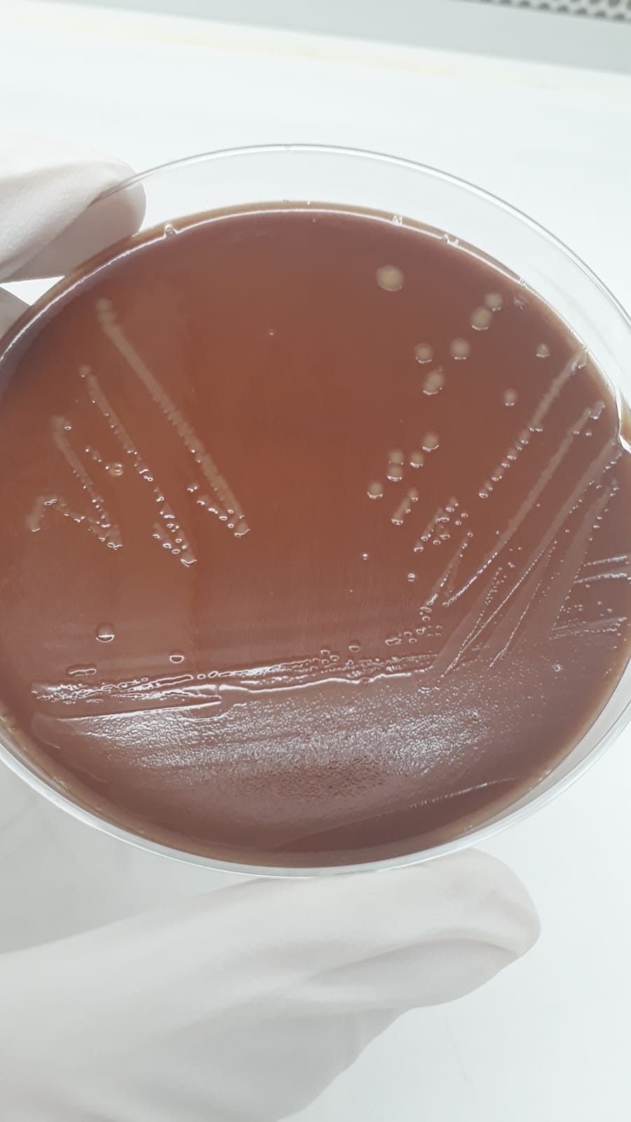 Estratégia molecular inédita permite monitorar mais rapidamente ...